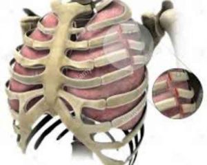 What is Costochondral Separation? | Causes | Symptoms | Treatment ...